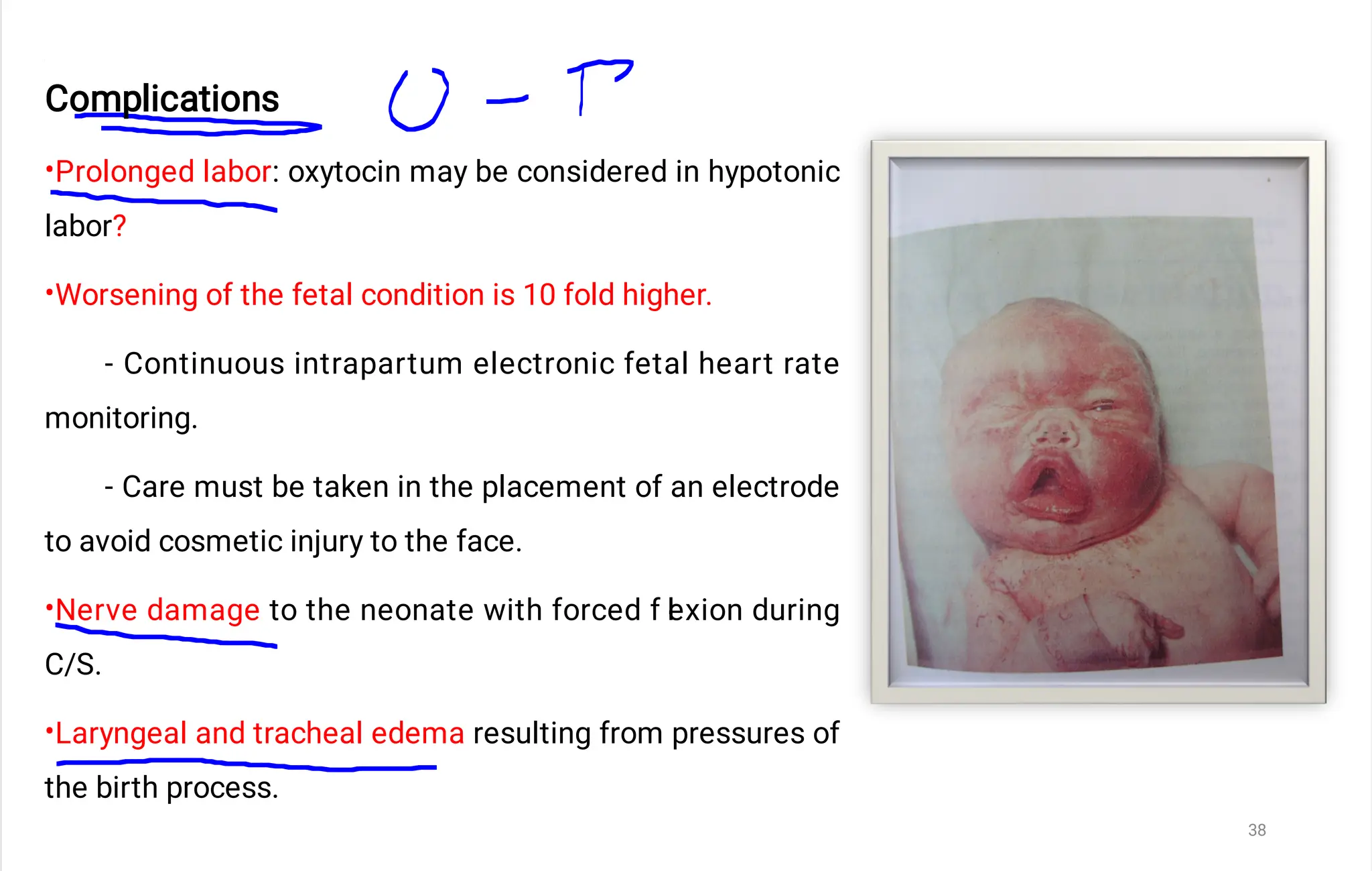 MALPRESENTATION AND MALPOSITION.pdf