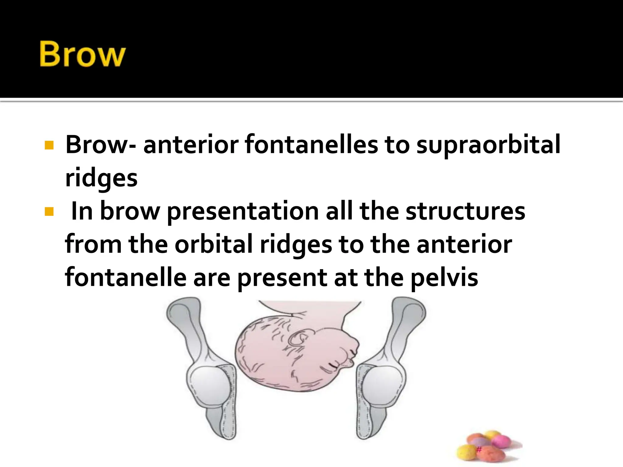 malpresentationfacebrow-170507205628.pptx