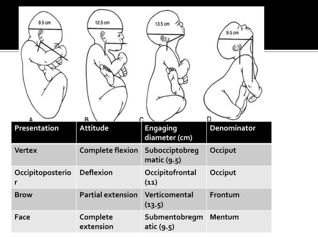 Malpresentation (face, brow) | PPTX