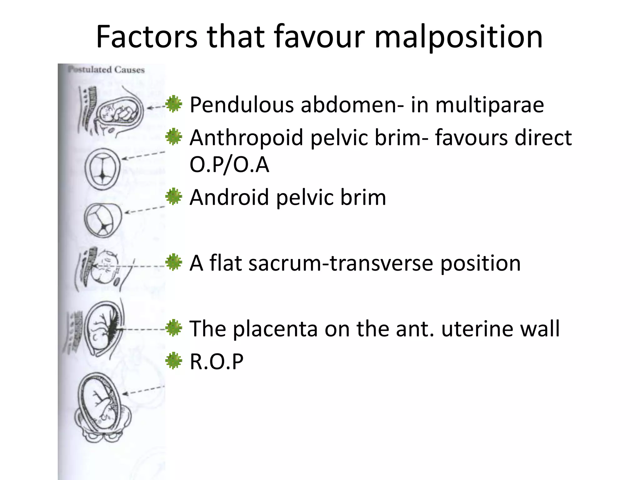 Malpresentation malposition by ILI | PPTX