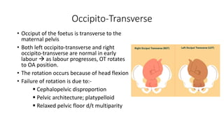 Malpresentation & malposition.pptx