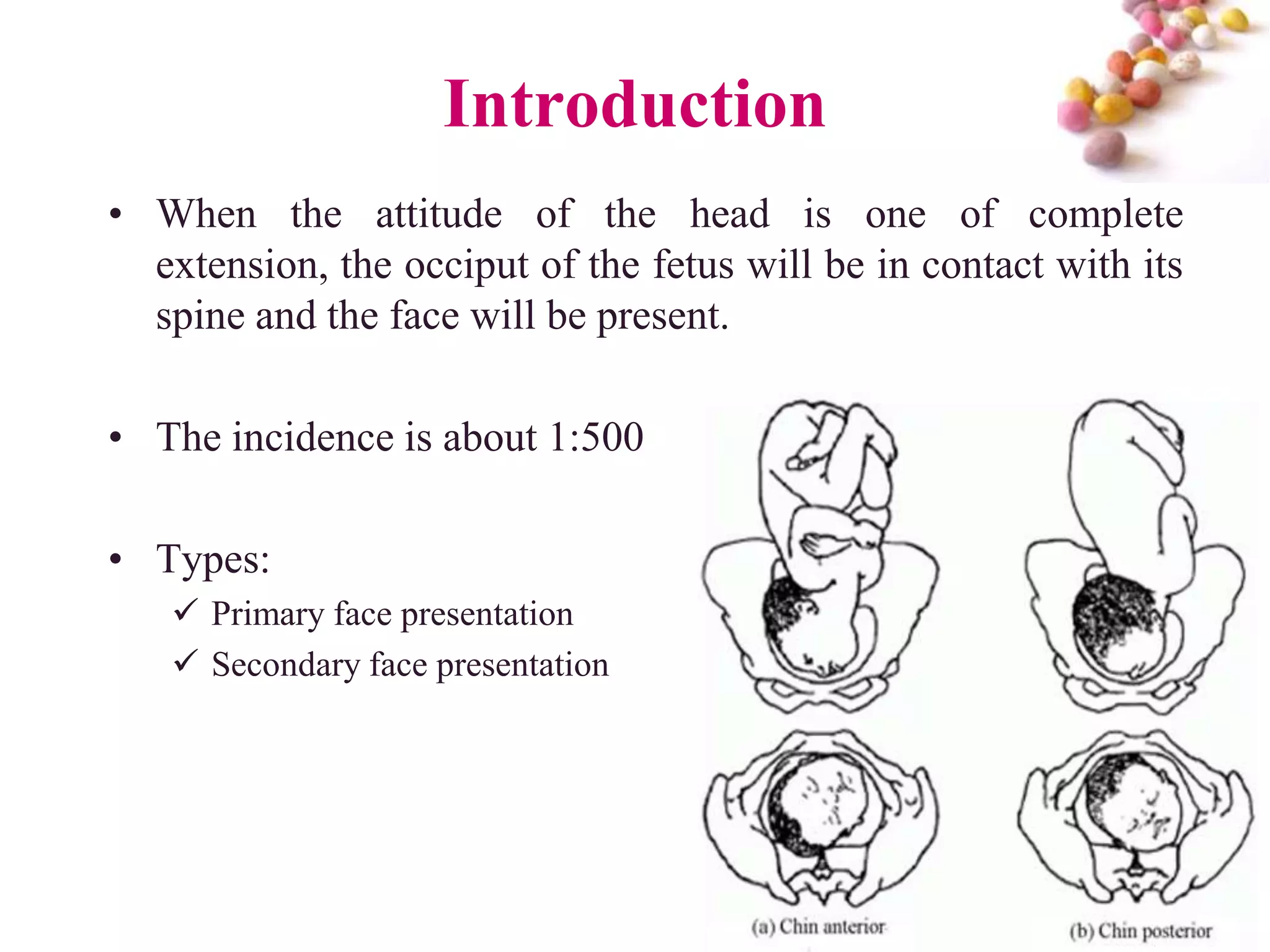 Malpresentations | PPTX