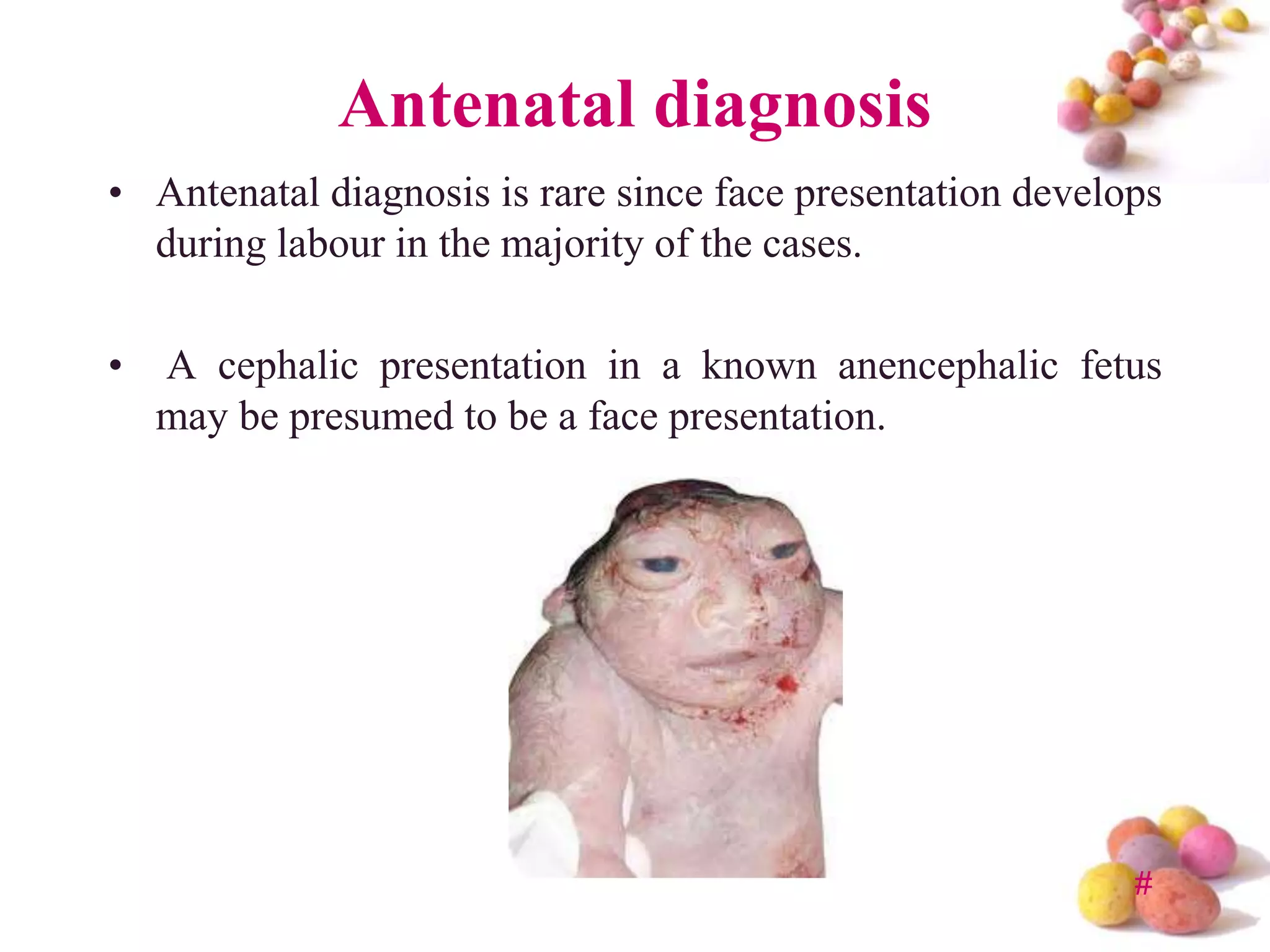 Malpresentations | PPTX
