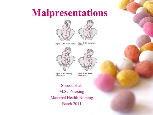 Malpresentations | PPTX | Pregnancy | Reproductive Health