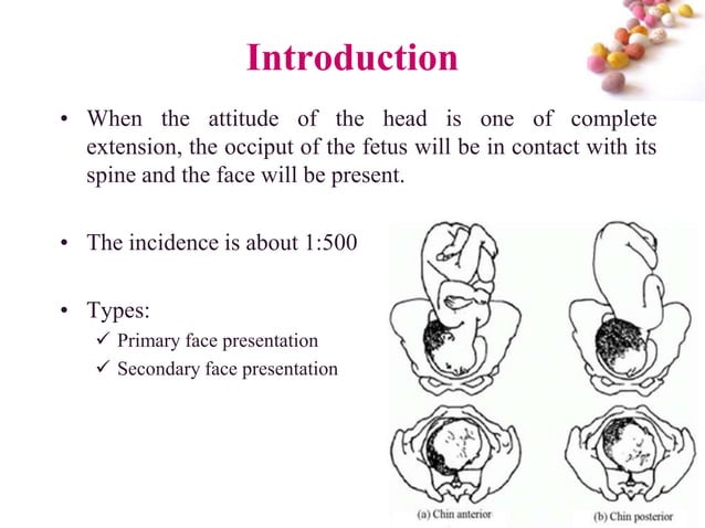 Malpresentations | PPTX | Pregnancy | Reproductive Health