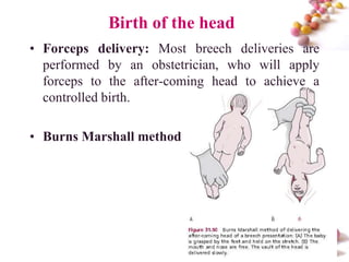 Malpresentations | PPTX