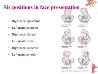 Face Presentations And Positions
