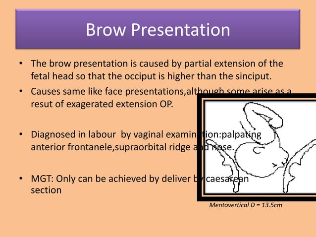 Malpresentations&malpositions | PPTX