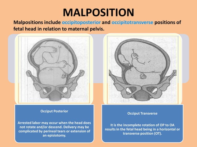 Malpresentations&malpositions | PPTX