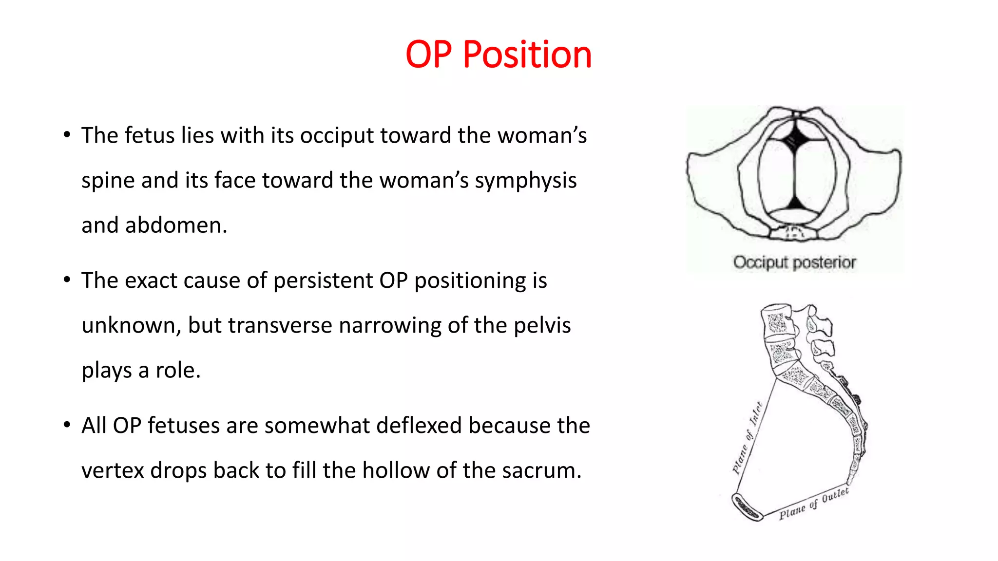 Malpresentations & Malpositions copy.pptx