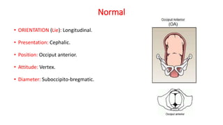 Malpresentations & Malpositions copy.pptx