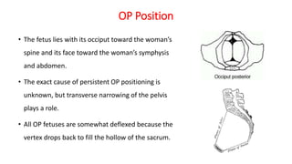 Malpresentations & Malpositions copy.pptx