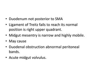 Malrotation | PPTX
