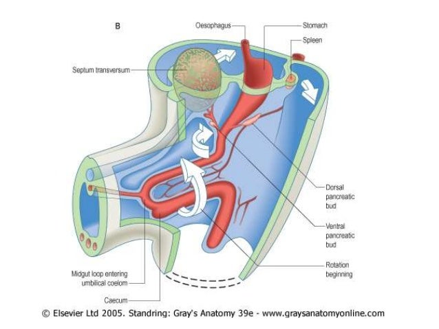 Ligament Of Treitz Malrotation The Radiology Of Malrotation