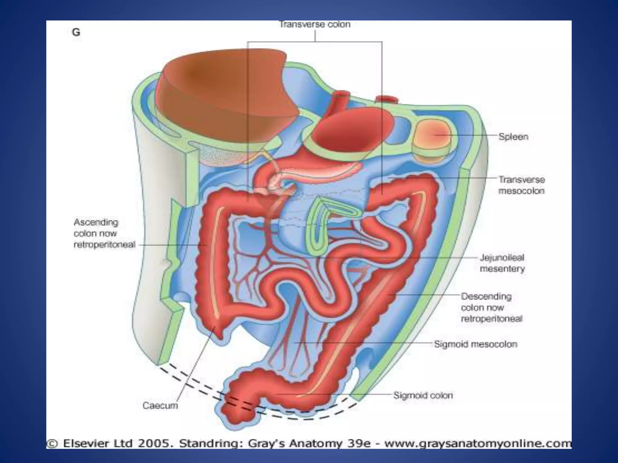 Malrotation of gut | PPTX