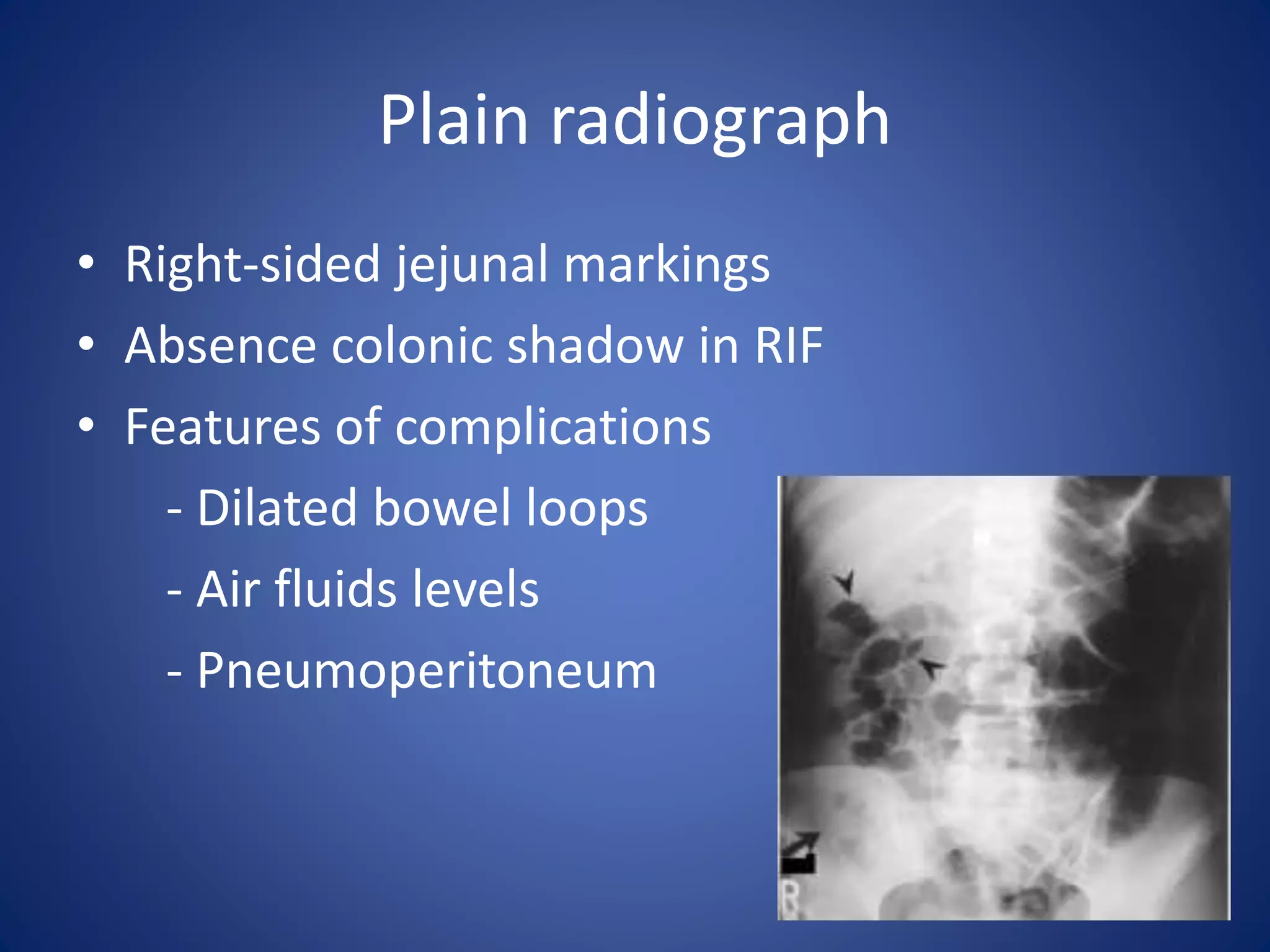Malrotation of gut | PPTX