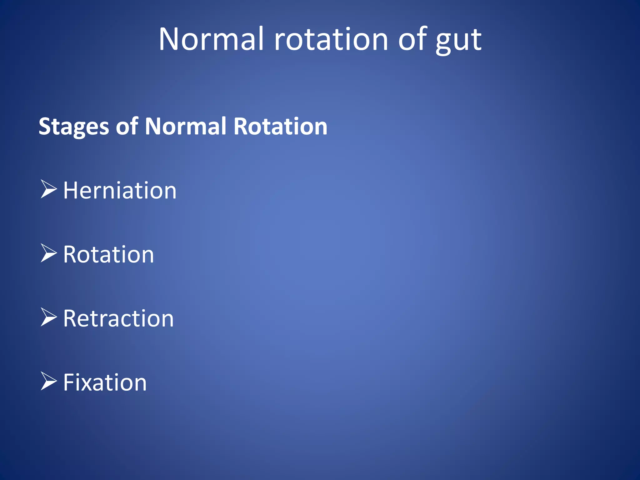 Malrotation of gut | PPTX