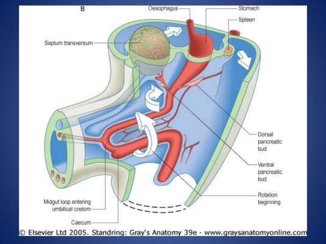 Malrotation of gut | PPTX | Digestive Disorders | Diseases and Conditions