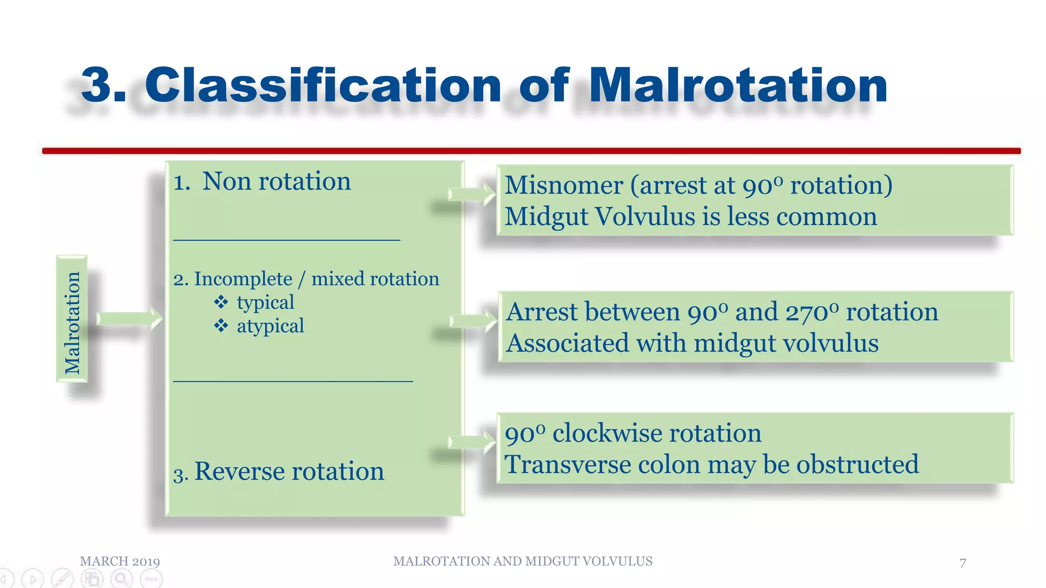 MALROTATION & MIDGUT VOLVULUS final.pdf