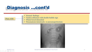 MALROTATION & MIDGUT VOLVULUS final.pdf