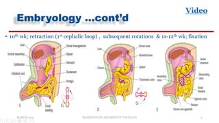 MALROTATION & MIDGUT VOLVULUS final.pdf