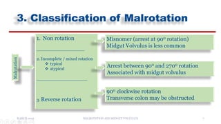 MALROTATION & MIDGUT VOLVULUS final.pdf