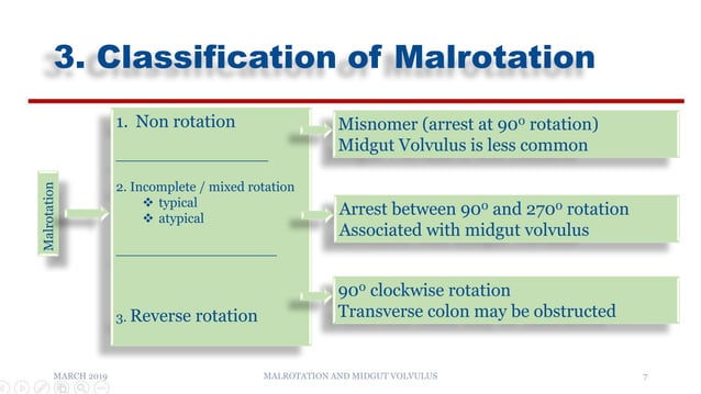 MALROTATION & MIDGUT VOLVULUS final.pdf