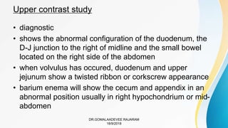 Malrotation with midgut volvulus.pptx