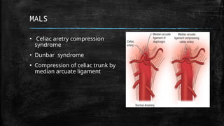 Median arcuate ligament syndrome with celiac Stenois | PPTX