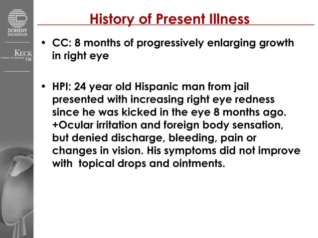 Conjunctival MALT Lymphoma | PPT | Eye and Vision Conditions | Diseases ...