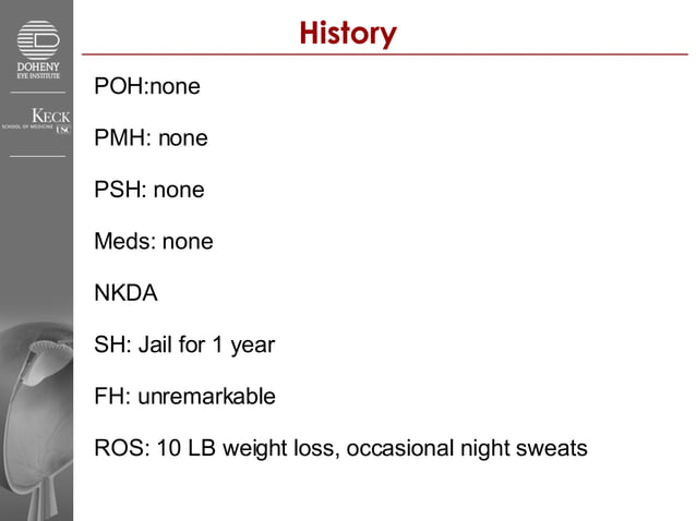 Conjunctival MALT Lymphoma | PPT | Eye and Vision Conditions | Diseases ...