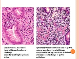 Gut Associated Lymphoid Tissue Histology
