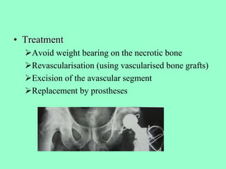 Malunion_Delayed_Union_and_Nonunion_fractures.ppt