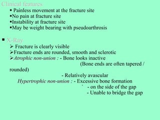 Malunion_Delayed_Union_and_Nonunion_fractures.ppt