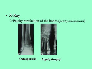 Malunion_Delayed_Union_and_Nonunion_fractures_4.ppt