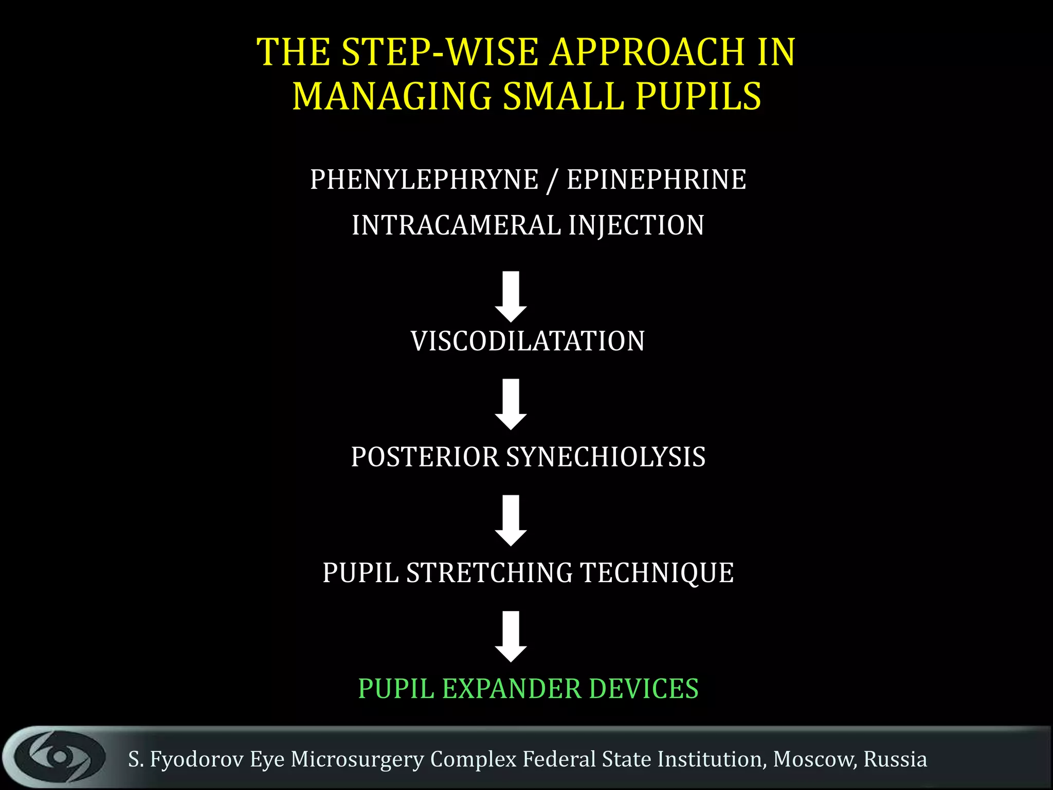Surgical strategies for small pupils - Malyugin Ring | PPTX
