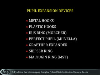 Surgical strategies for small pupils - Malyugin Ring | PPTX