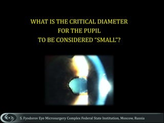 Surgical strategies for small pupils - Malyugin Ring | PPTX