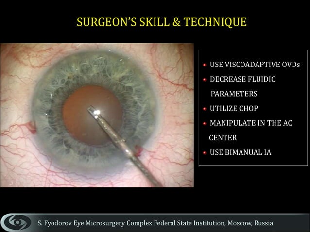 Surgical strategies for small pupils - Malyugin Ring | PPTX