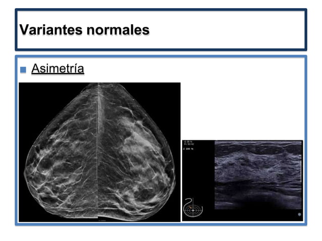 mama diapositivas.pptx