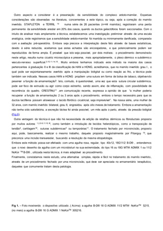 Mamilo Invertido Cirurgia com Microincisão com Agulha.docx
