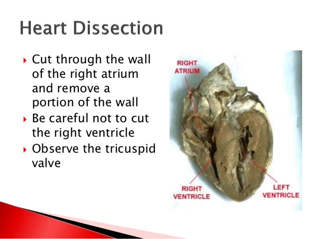 Mammal Heart Dissection