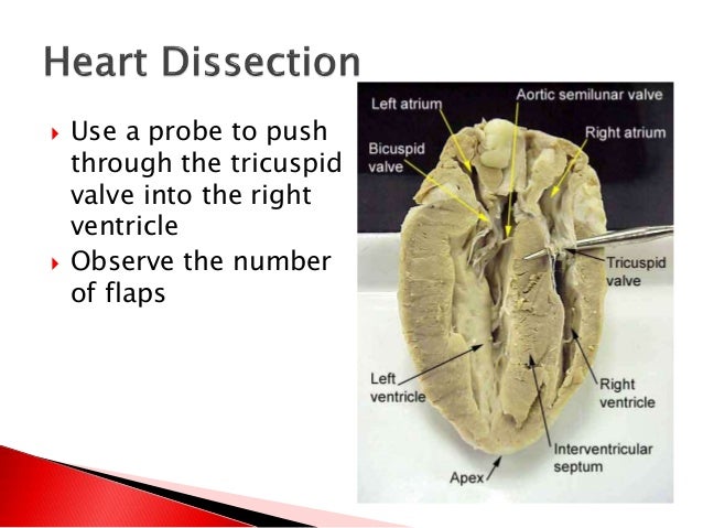 Mammal Heart Dissection