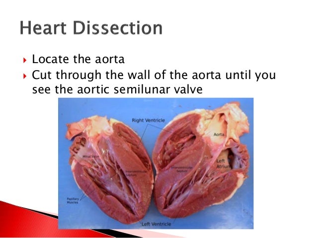 Mammal Heart Dissection