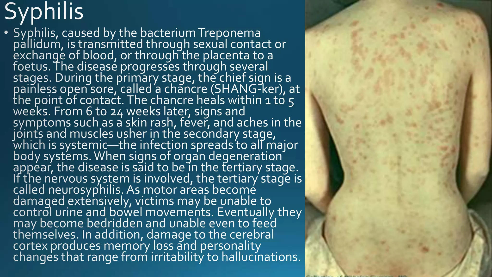 Mammalian reproductive physiology: REPRODUCTIVE DYSFUNCTIONS ...