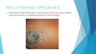 ANATOMY OF MAMMARY GLAND WITH CLINICAL ANATOMY | PPTX