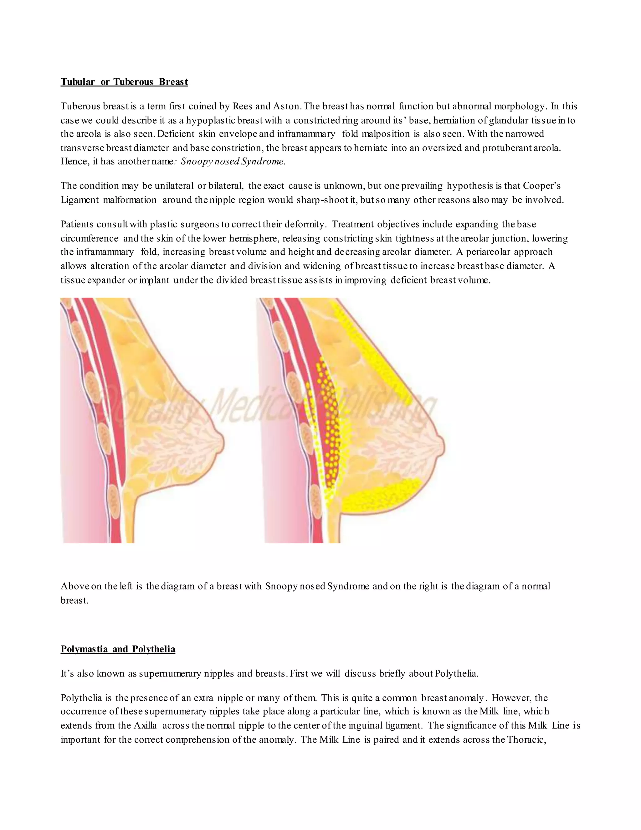 Mammary gland and its birth anomalies with characteristics in other ...