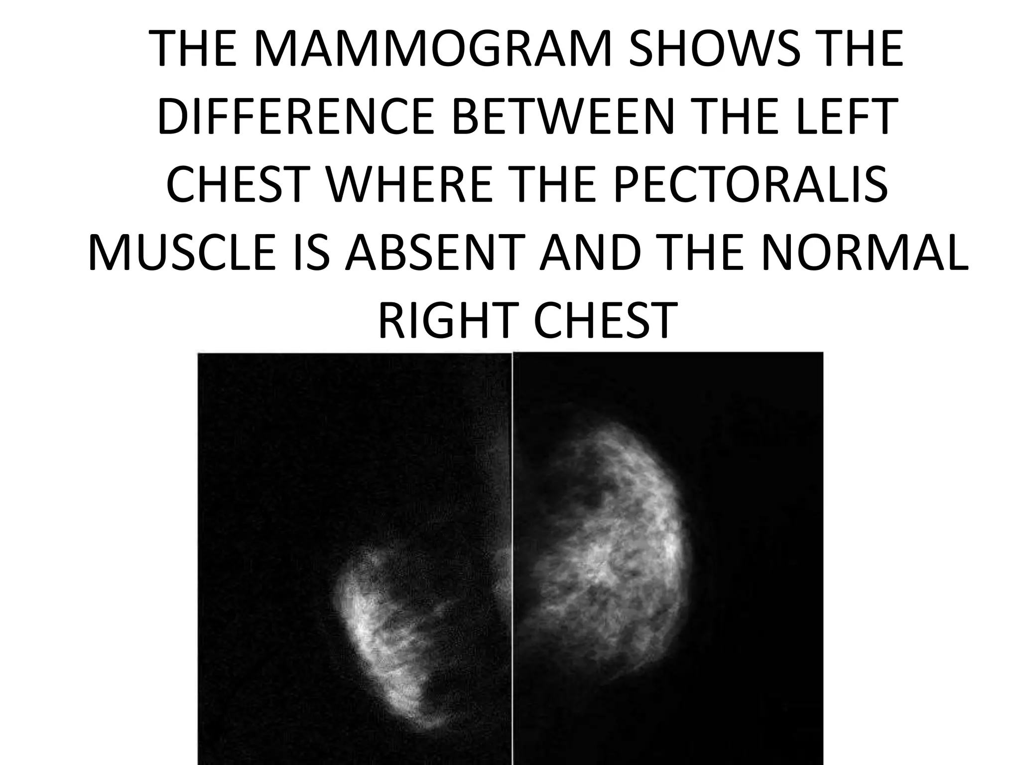 Mammary glands and birth anomalies | PPTX