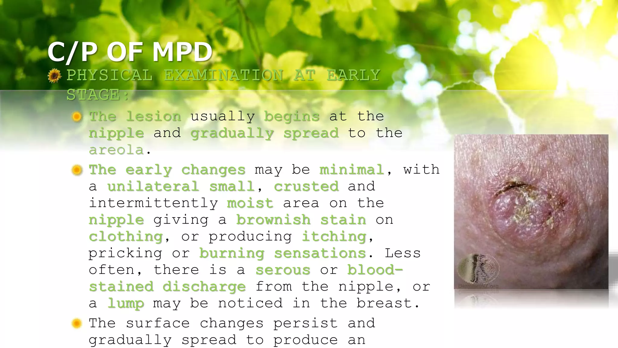 Mammary Paget Disease (MPD) & Extramammary Paget disease (EMPD) | PPTX