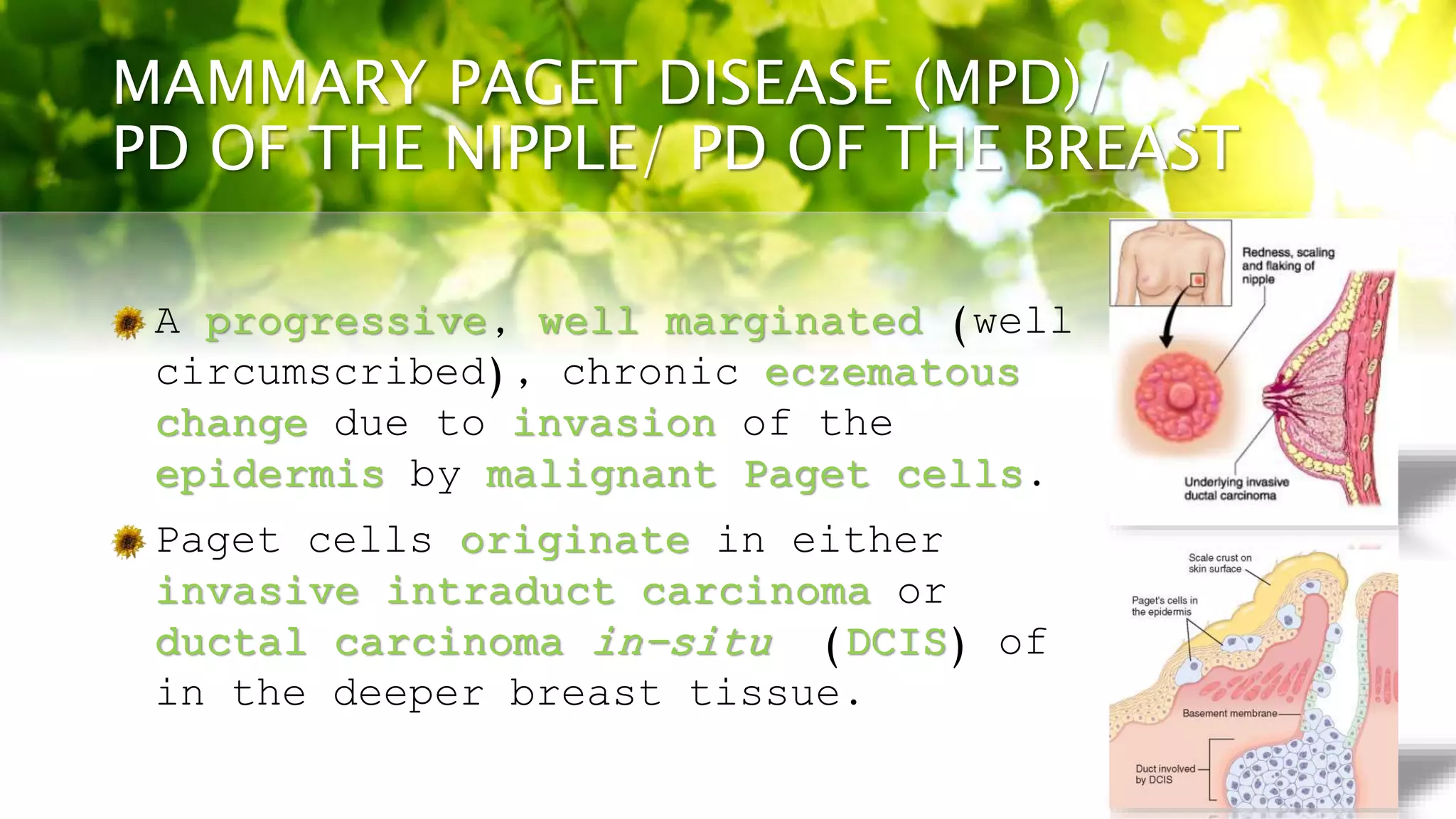 Mammary Paget Disease (MPD) & Extramammary Paget disease (EMPD) | PPTX